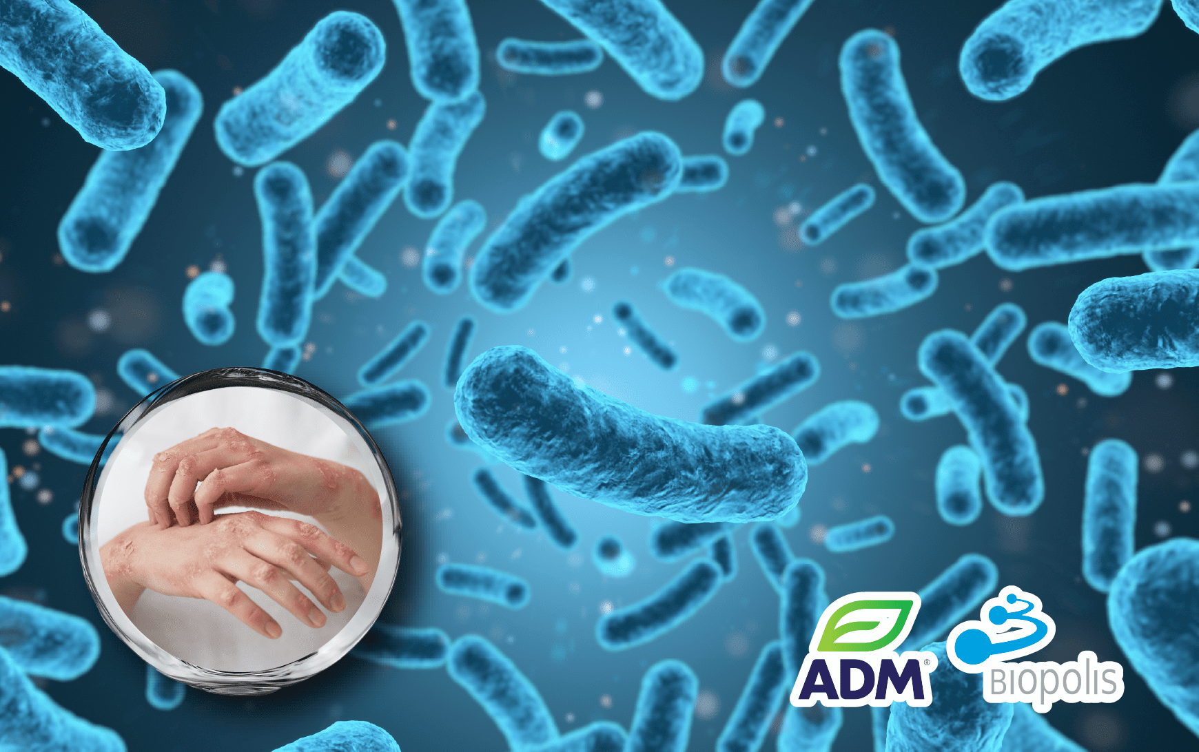 ADM Biopolis｜AD-1 皮膚健康複方菌｜三株益生菌複方